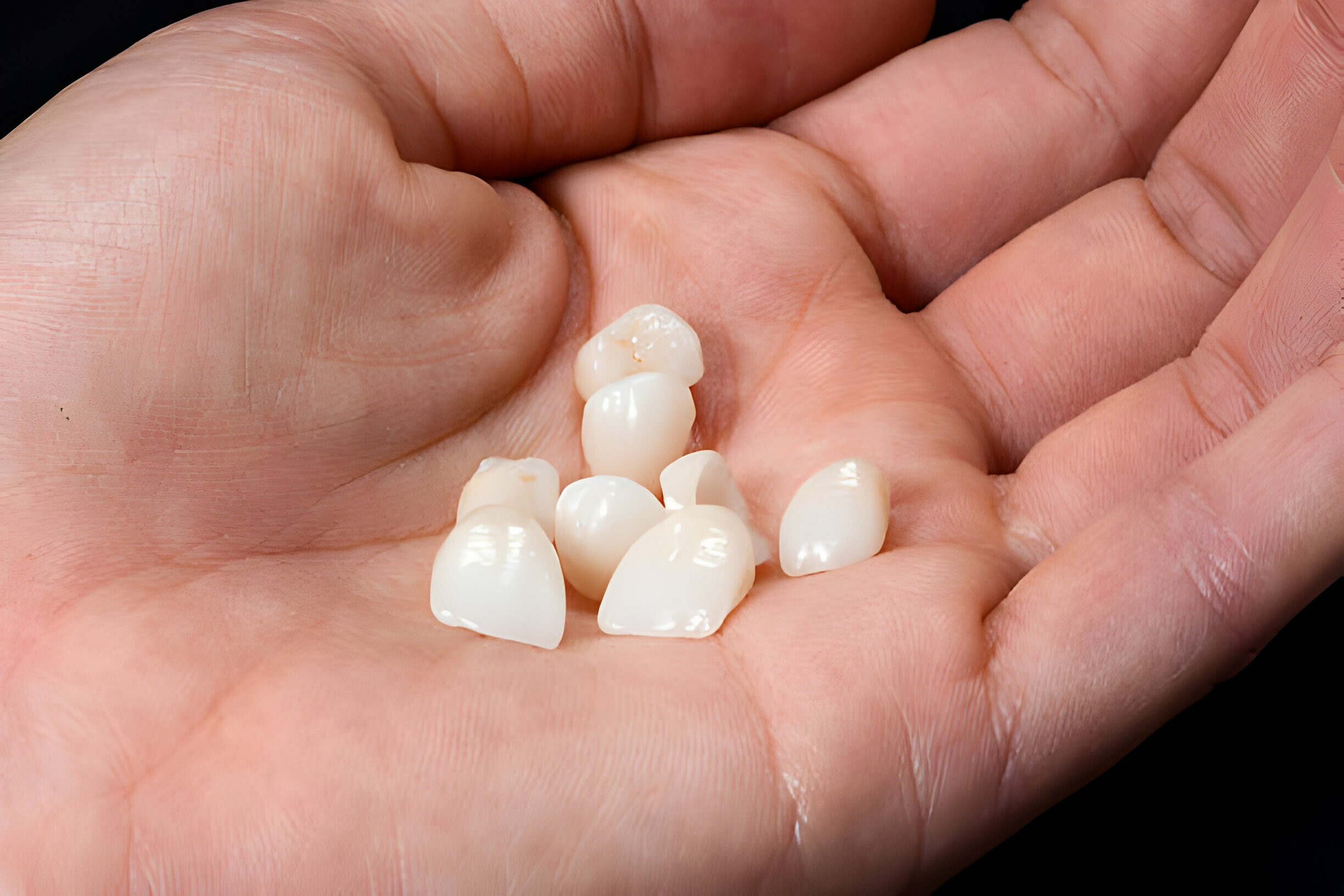 Why Should You Choose Charlotte Dental Esthetics?