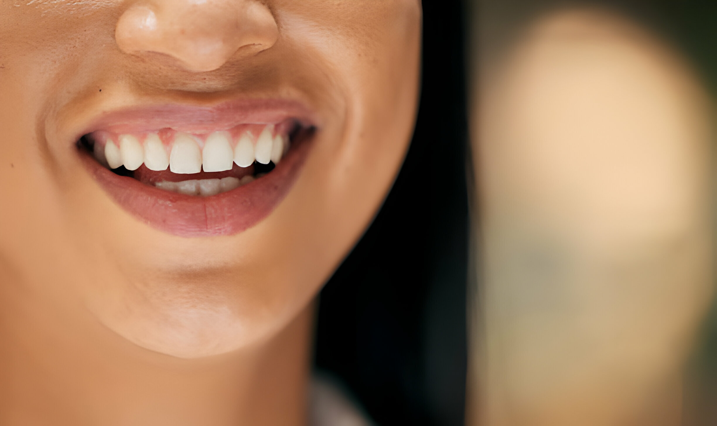 How To Maintain Your Bright Smile: Post-Whitening Care Tips