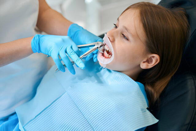 Expert Guide to Post-Tooth Extraction Care in Charlotte